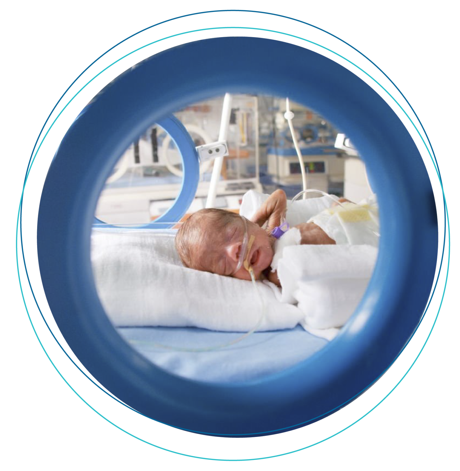 Developmental Supportive Care for Preterm Babies